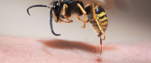 Buzzy® e le Punture o Morsi di insetto